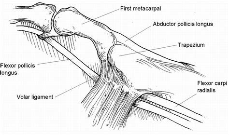 Fractures Of The Base Of The First Metacarpal Current Treat Jaaos Journal Of The
