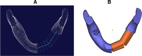 Calculation By An Optimal Program And The Design Of Model For Mandible