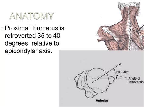 Proximal Humerus Fractures Ppt
