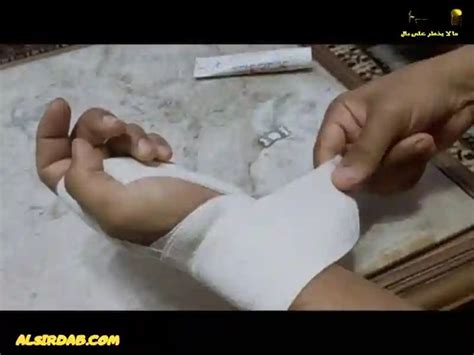 يد مجروحة ملفوفة بشاش Save Quick