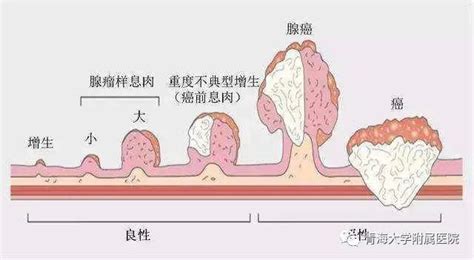 健康生活，只“胃”你 青海大学附属医院