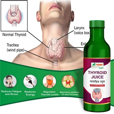 Ayurvedic Medicine And Treatment For Thyroid Thyroid Juice