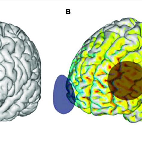Transcranial Direct Current Stimulation Tdcs Electrode Placement Download Scientific