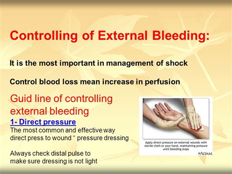 External Bleeding Treatment