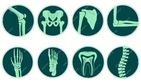 Orthopedic Clipart 3977352 Clipart Library