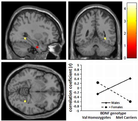 Bdnf Genotype By Sex Interaction Affects Rcbf Functional Connectivity Download Scientific Diagram