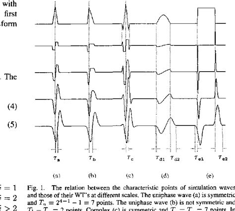 figure 1 from detection of ecg characteristic points using wavelet
