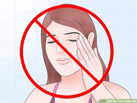 3 Ways To Treat Folliculitis WikiHow