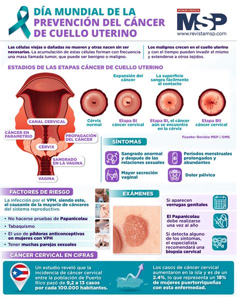 CÁncer De Cuello Uterino
