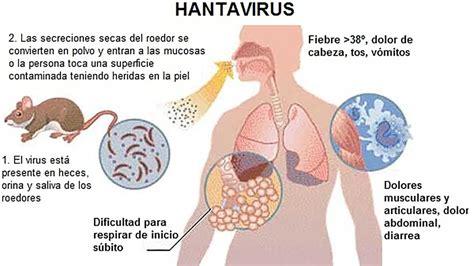 Hantavirus ¿qué Es Cómo Se Contagia Y Cómo Se Previene Infobae