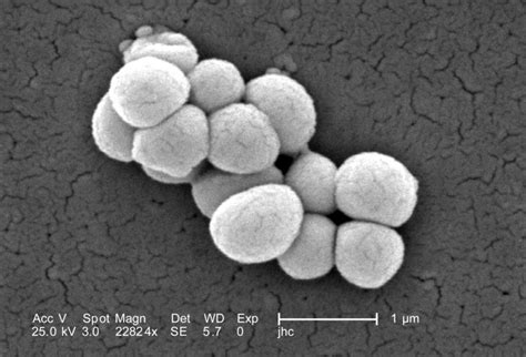 Micrococcus Luteus Alchetron The Free Social Encyclopedia