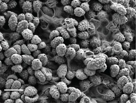 Sponorma Squarepantsii The Spongebob Mushroom Annas Blog