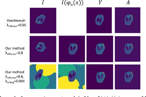 Towards Segmentation And Spatial Alignment Of The Human Embryonic Brain Using Deep Learning For