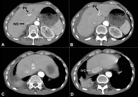 Vajira Medicine วันนี้เรามาเปิดโลกกว้างในการ Approach