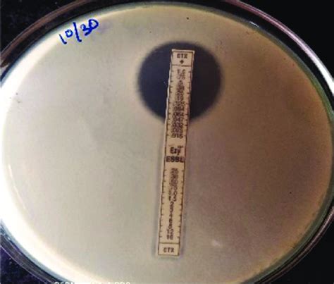 E Test Showing Esbl Production Is Depicted Figure 6 Double Disk Download Scientific Diagram