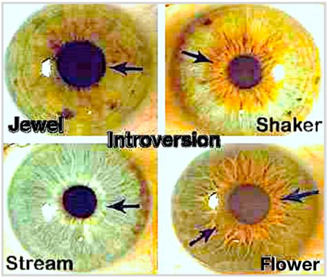 Mbti Introvert Vs Extrovert Anatomy Part 2 Heal And Grow For Acoas