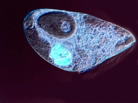 Blepharisma Under Microscope