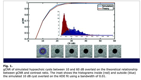 Gcnr Regularization Improves Deep Neural Network Beamformers Valiant