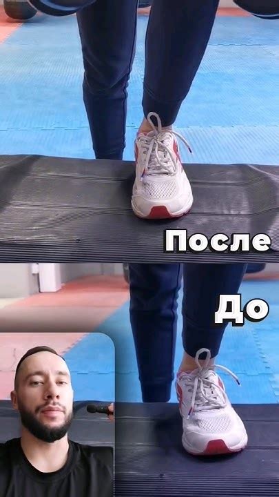 Гиперпронация стопы и задняя большеберцовая мышца👣 Youtube