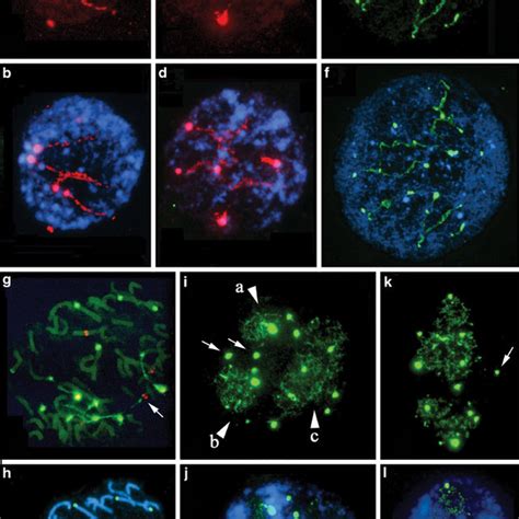Schematic Diagram Showing The Igs Structure Between The 26s And 18s