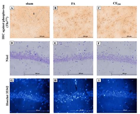 Histological Alterations Of The Ca1 Area Of The Hippocampus Following