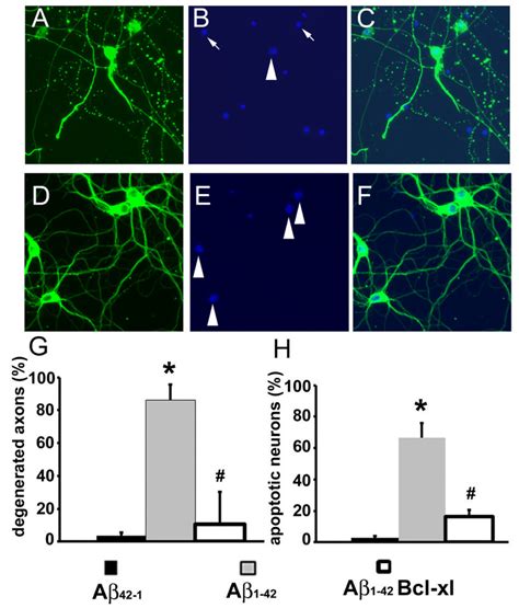 Bcl Xl Over Expression Prevents Both Axonal Degeneration And Cell Death Download Scientific