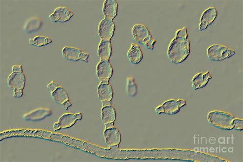 Phytophthora Infestans Microscope