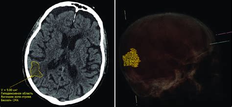 marking and tagging areas of interest on dicom images with 3d region of