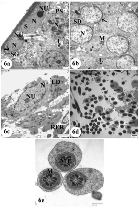 A E Electron Micrographs Of Ultrathin Sections Of Testis Of Control