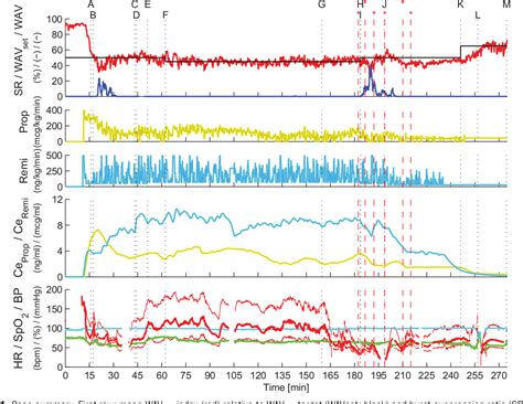 Figure 1 From Closed Loop Control Of Total Intravenous Anesthesia