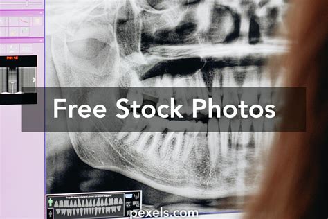 Ct Scan For Teeth Photos Download The Best Free Ct Scan For Teeth