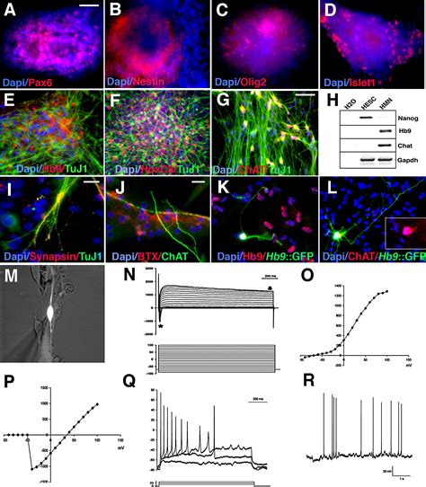 Non Cell Autonomous Effect Of Human Sod1g37r Astrocytes On Motor Neurons Derived From Human