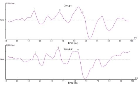 Representative Waveform Of Abr For Group 1 And Group 2 Abr Brainstem Download Scientific
