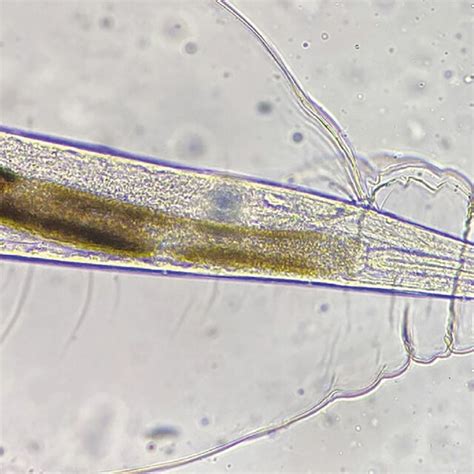 The Cephalic End Of A Female H Invaginatus Photo By I V Suvorova Download Scientific Diagram