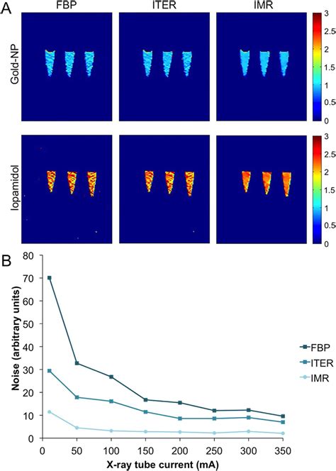 Effect Of Reconstruction Algorithm In Dual Energy Ct A Dual Energy Download Scientific