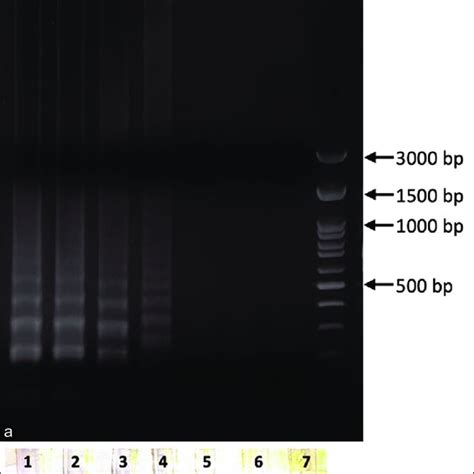 Detection Limit Of Loop Mediated Isothermal Amplification Using Heat