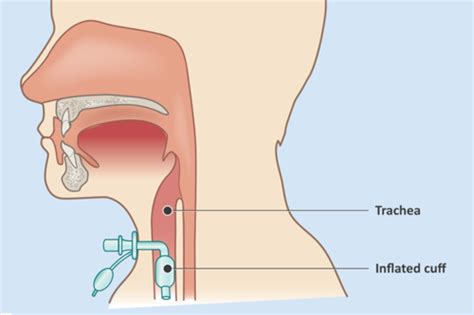 Week 9 Oxygenation And Perfusion Assess And Recognize Cues Implement