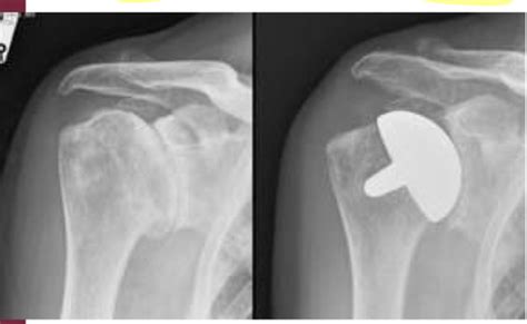 Clinical Applications Final Exam Exam 4 Flashcards Quizlet