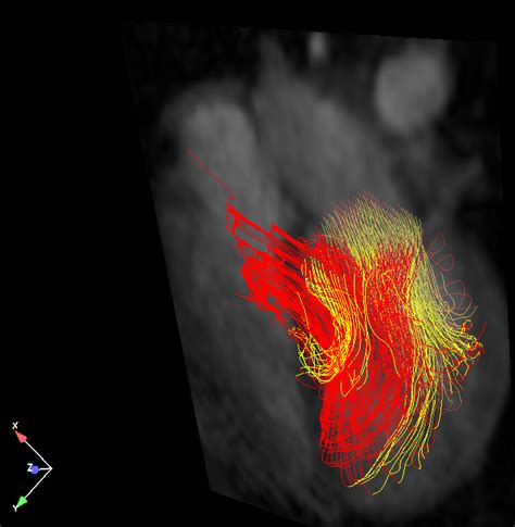Particle Trace Visualization Example The Red Traces Belong To The