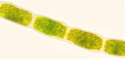 C External Morphological Abnormalities In Zygnema Sp 100x