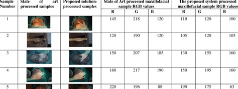Accuracy Visualization Error Results For Maxillofacial Samples