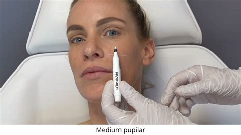 Profhilo Bio Aesthetic Points Bap Technique Explained By Dr Gabriel Siquier Youtube