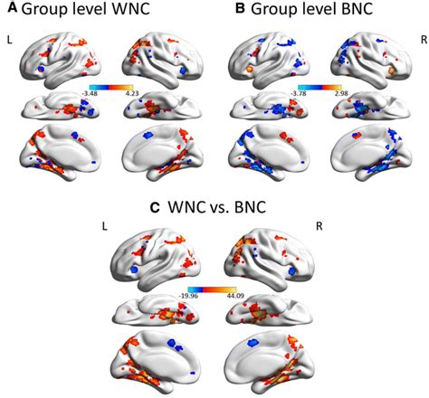 Group Patterns Of The Within Network Connectivity Wnc And