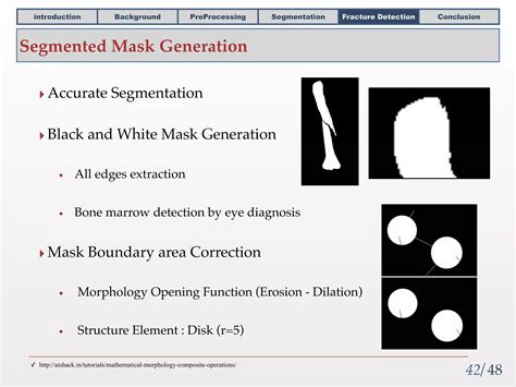 Master Thesis Long Bone Segmentation And Fracture Detection In X Ray Master Thesis Long Bone Segmentation And Fracture Detection In X Ray