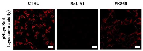 The Role Of Autophagy In Neuronal Health And Function Dojindo Laboratories