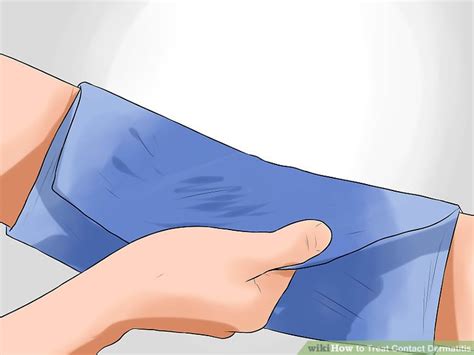 How To Treat Contact Dermatitis 15 Steps With Pictures