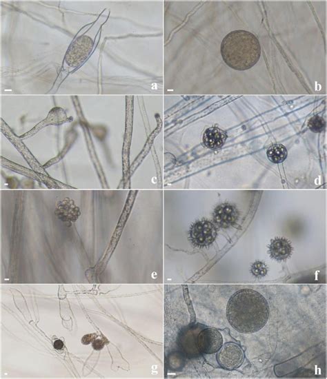A B Phytophthora Undulata He Petersen Mw Dick A Zoosporangium