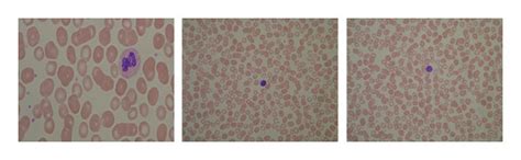 Platelet Masks And Pixelwise Labeling A Original Image B Platelet