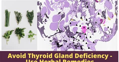 Avoid Thyroid Gland Deficiency Use Herbal Remedies Dgs Health