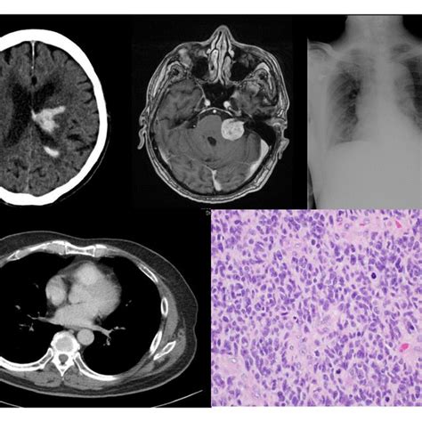 Pdf Deep Learning Applications In Medical Image Analysis